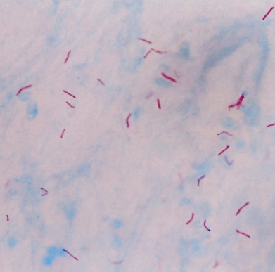 Ziehl - Neelsen (Acid fast bacteria) Cold - kit | 01TBC100T | Histoline